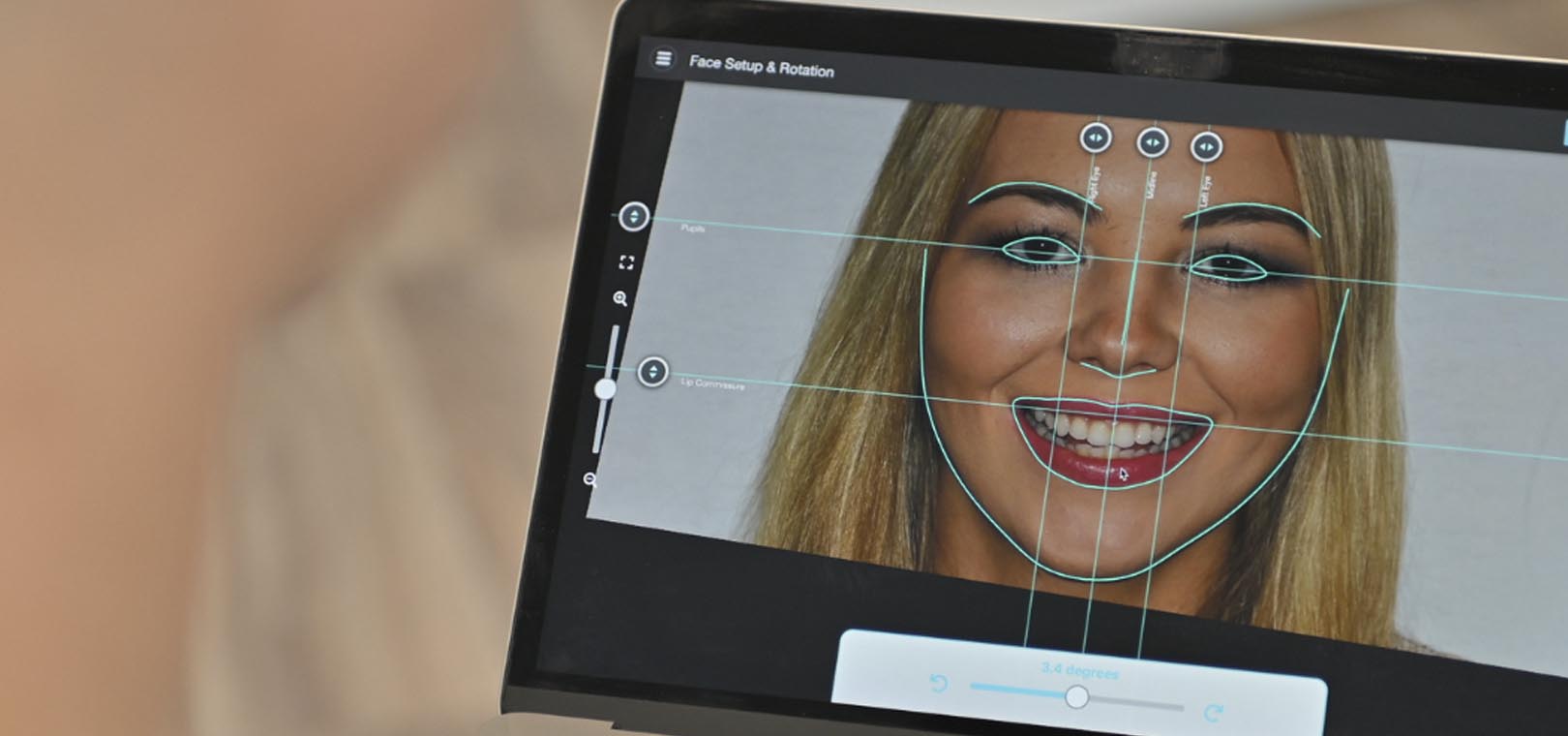 Zahnvorsorge der Zukunft: Frühzeitige Erkennung dank Künstlicher ...